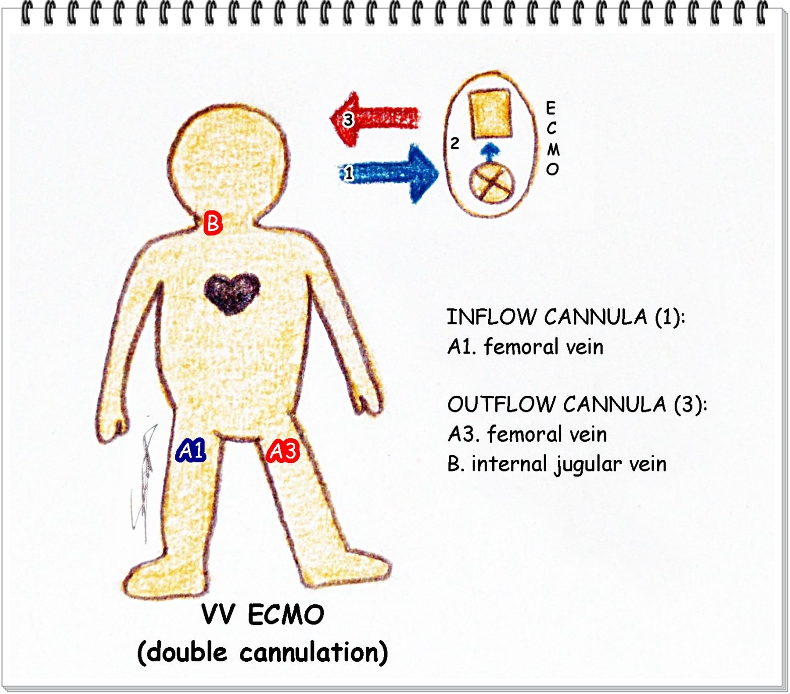 Crash ECMO - The Scrub Nurse