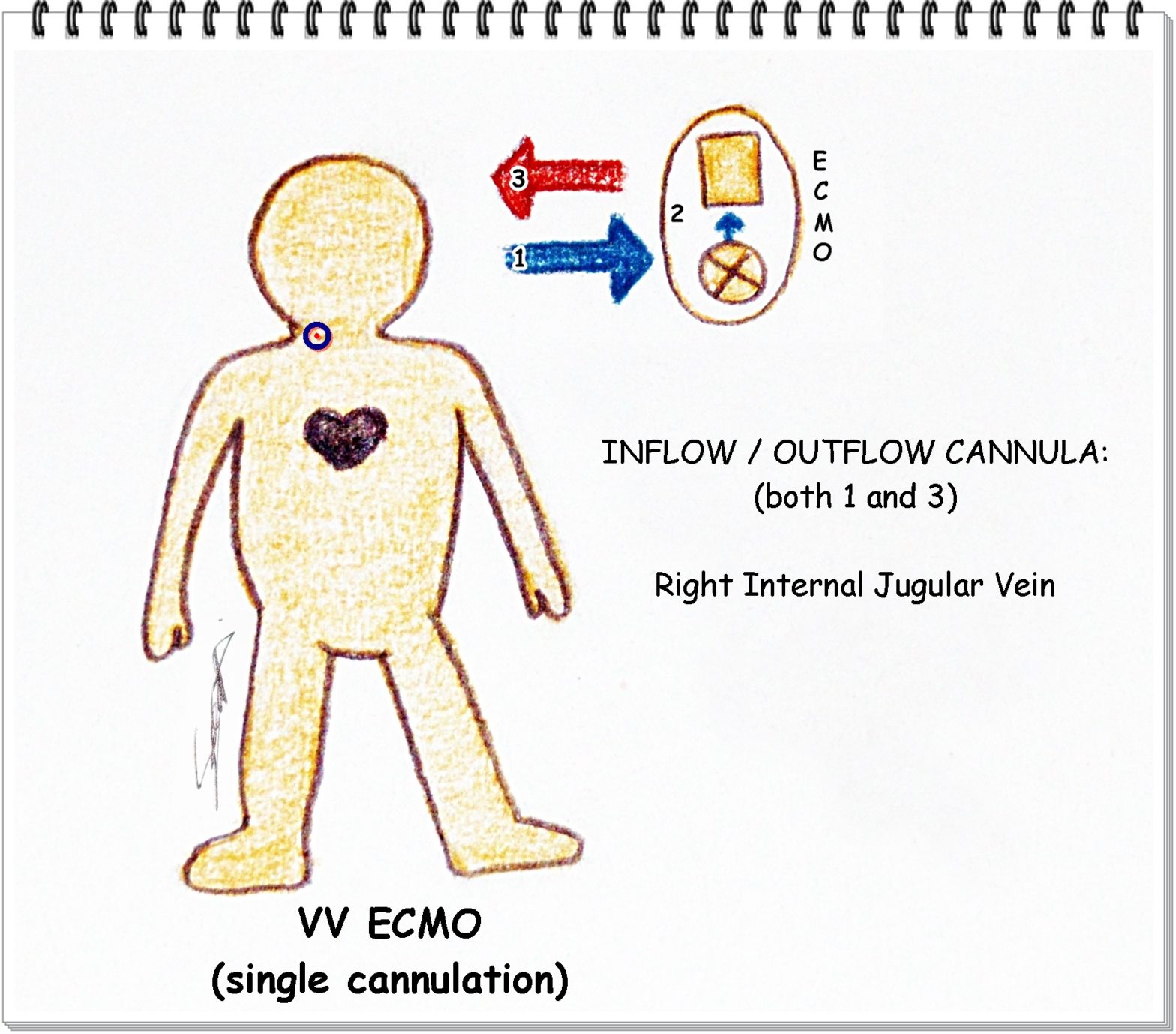 Crash ECMO - The Scrub Nurse